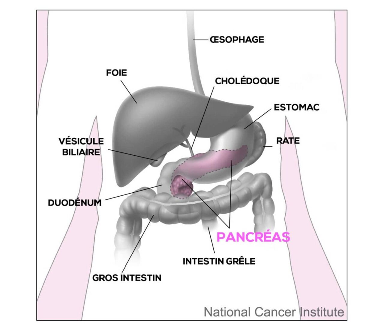 IHU Strasbourg | Pancréas : Duoénopancréatectomie céphalique